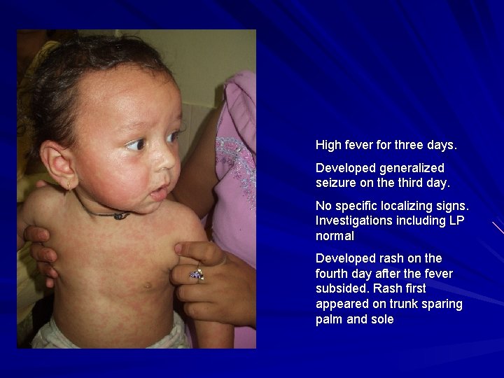 Measles and Neonatal Tetanus Clinical Signsand and Treatment