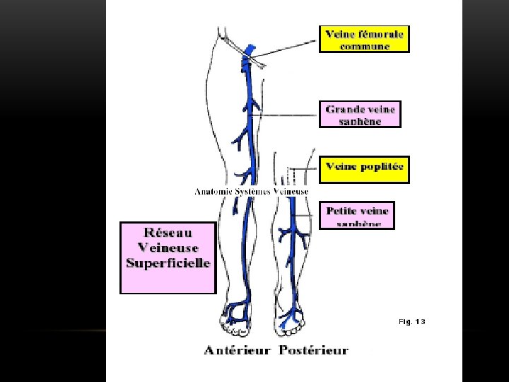 THROMBOSES VEINEUSES PROFONDES MEMBRES INFERIEURS Pr Bouayed Dr