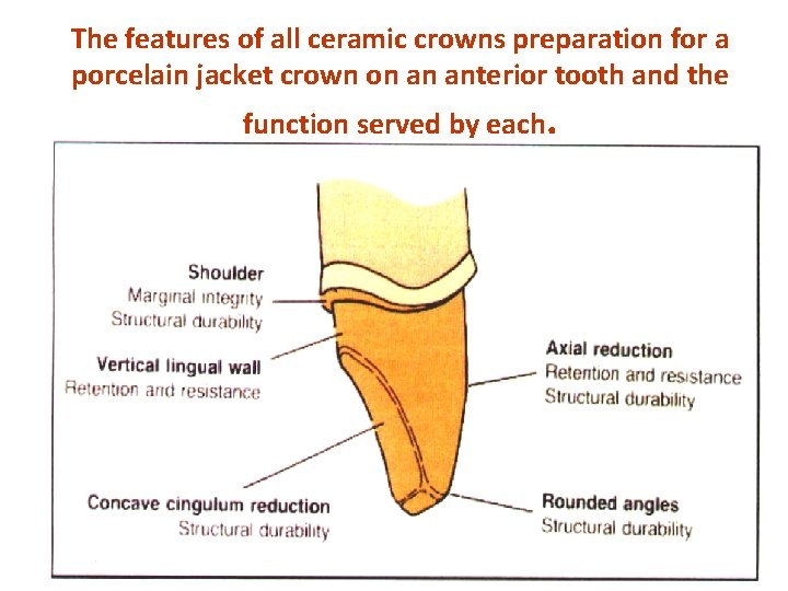 ALLCERAMIC CROWNS Indications When high esthetic requirement is