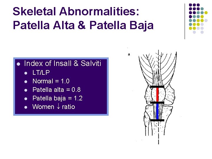 The Knee Complex The Knee Complex A B