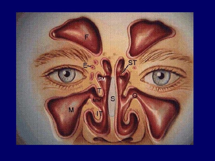 Choroby nosa a prnosovch dutn Prednky z otolaryngolgie