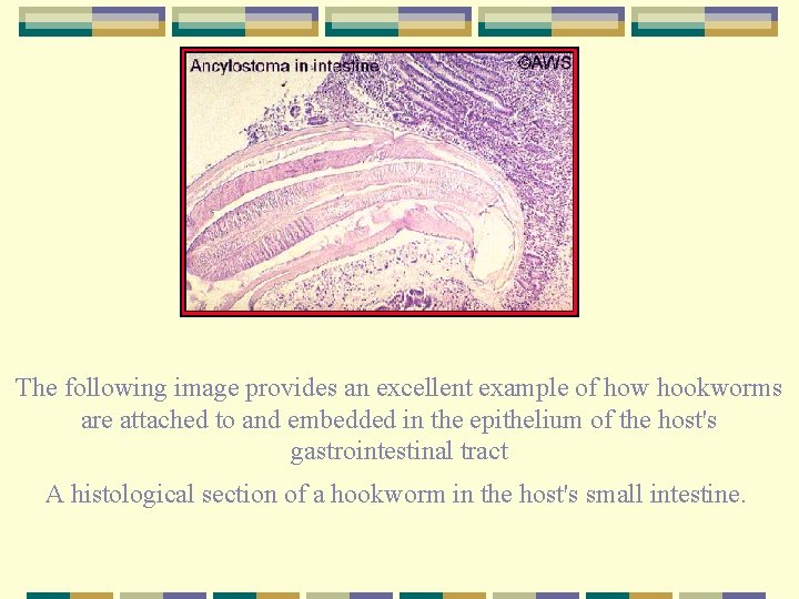 Hookworms Ancylostoma spp and Necator spp Human hookworm