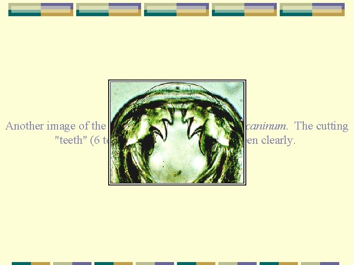 Hookworms Ancylostoma spp and Necator spp Human hookworm