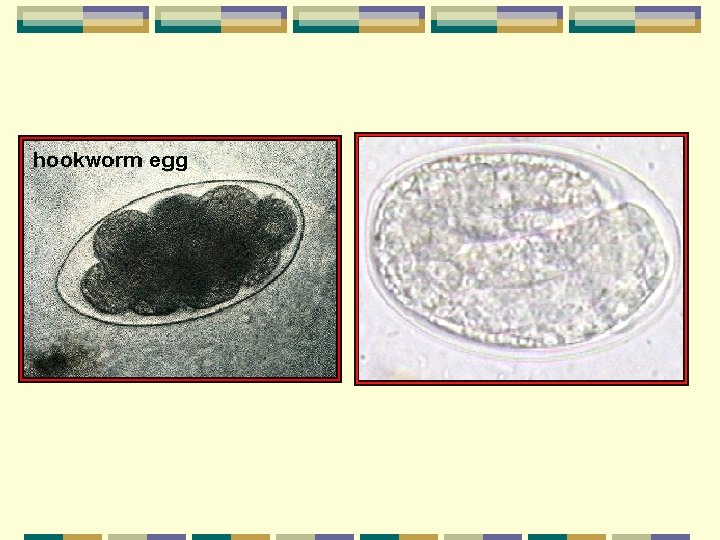 Hookworms Ancylostoma spp and Necator spp Human hookworm