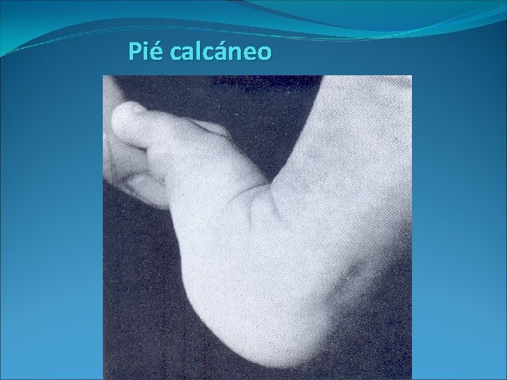 Facultad de Ciencias Mdicas Gral Calixto Garca Deformidades