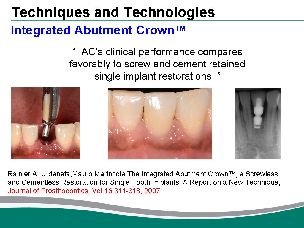 Techniques and Technologies Integrated Abutment Crown IACs clinical