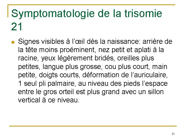 TRISOMIE 21 ou syndrome de Down Down syndrom