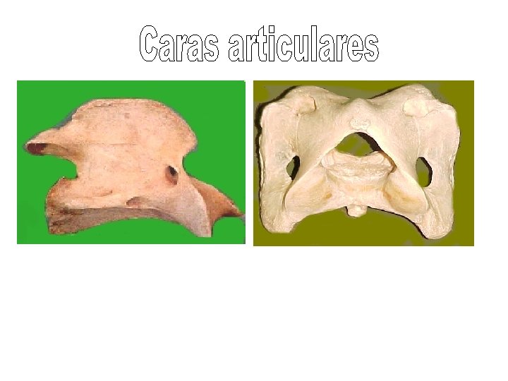 COLUMNA VERTEBRAL UNIONES DEL TRONCO UNIONES DEL TORAX