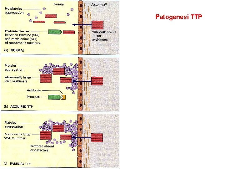 Disordini delle Piastrine Trombocitopenia Porpora Trombotica ...