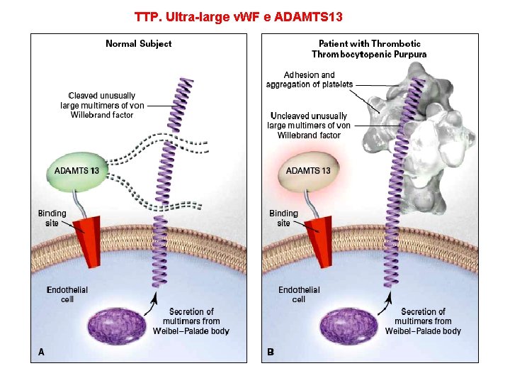 Disordini delle Piastrine Trombocitopenia Porpora Trombotica ...