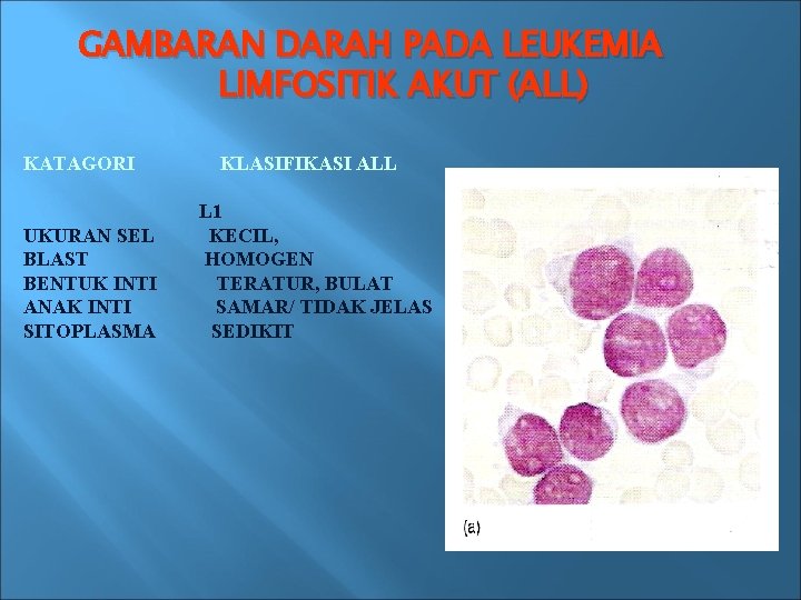 PEMERIKSAAN LABORATORIUM PADA LEUKEMIA AKUT BY dr RISMAWATI