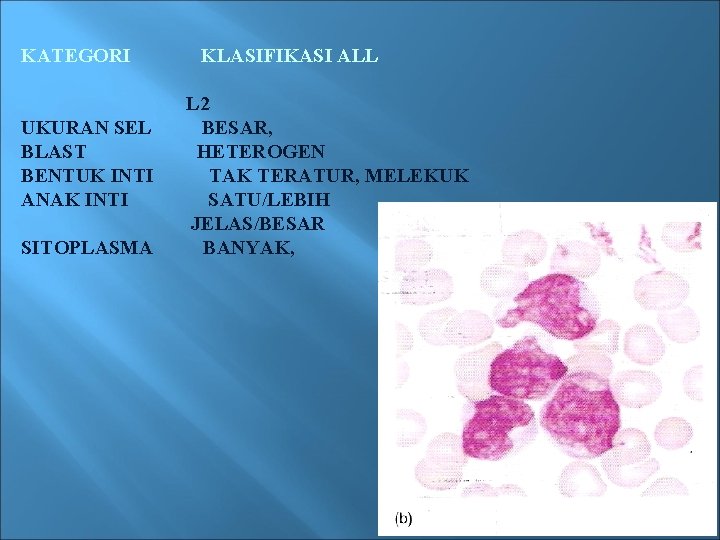 PEMERIKSAAN LABORATORIUM PADA LEUKEMIA AKUT BY dr RISMAWATI