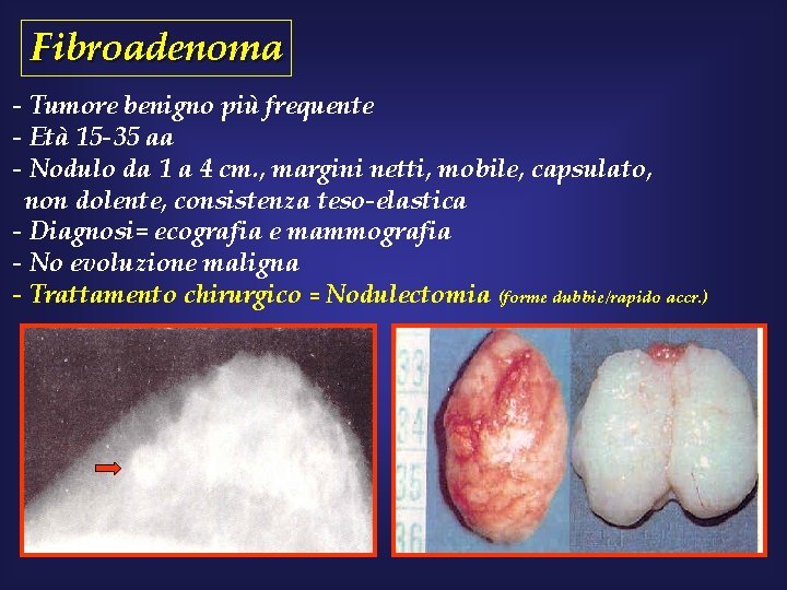 ANATOMIA della MAMMELLA ANATOMIA della MAMMELLA SISTEMA dei