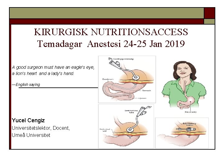 KIRURGISK NUTRITIONSACCESS Temadagar Anestesi 24 25 Jan 2019