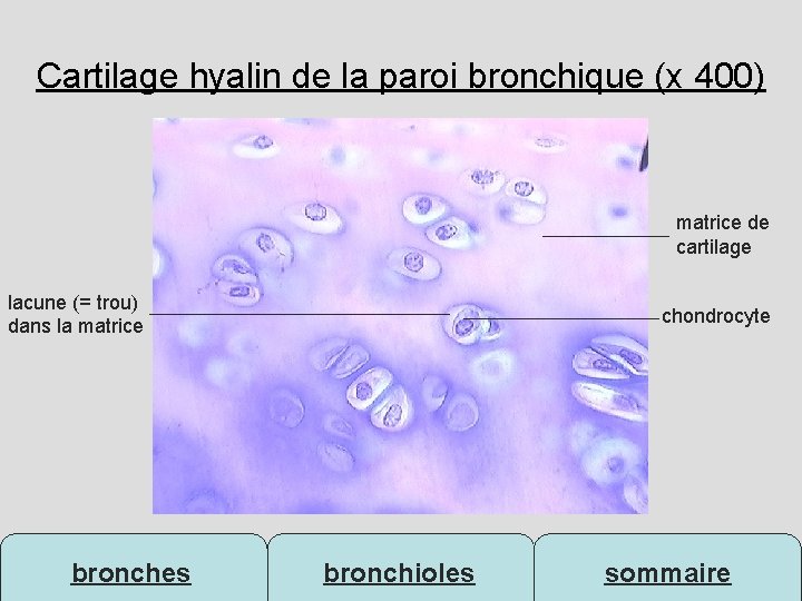 M Chosseler Histologie des bronches et des bronchioles