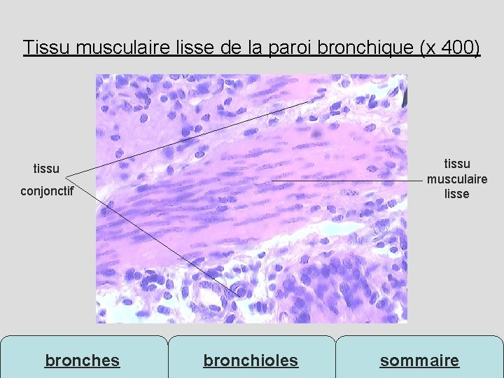 M Chosseler Histologie des bronches et des bronchioles