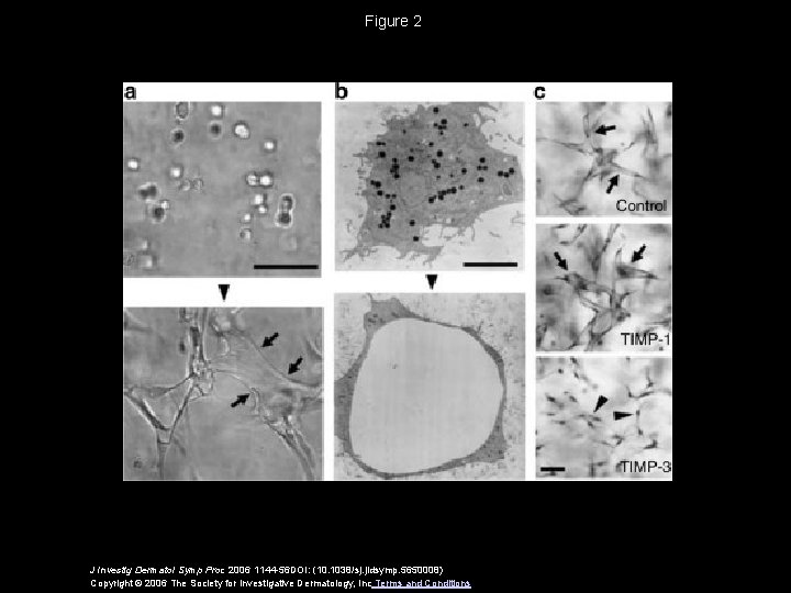 Molecular Balance of Capillary Tube Formation versus Regression