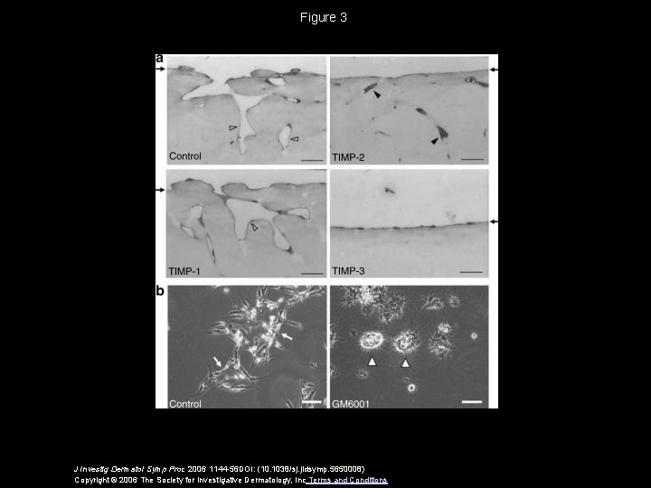 Molecular Balance of Capillary Tube Formation versus Regression