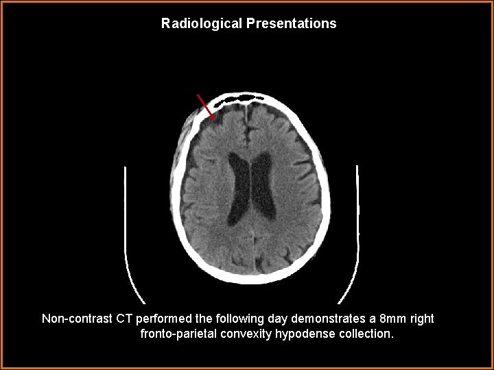 Radiological Category Neuroradiology Principal Modality 1 CT Principal