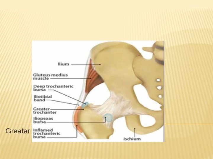 SOFT TISSUE CONDITIONS AROUND THE HIP Done by