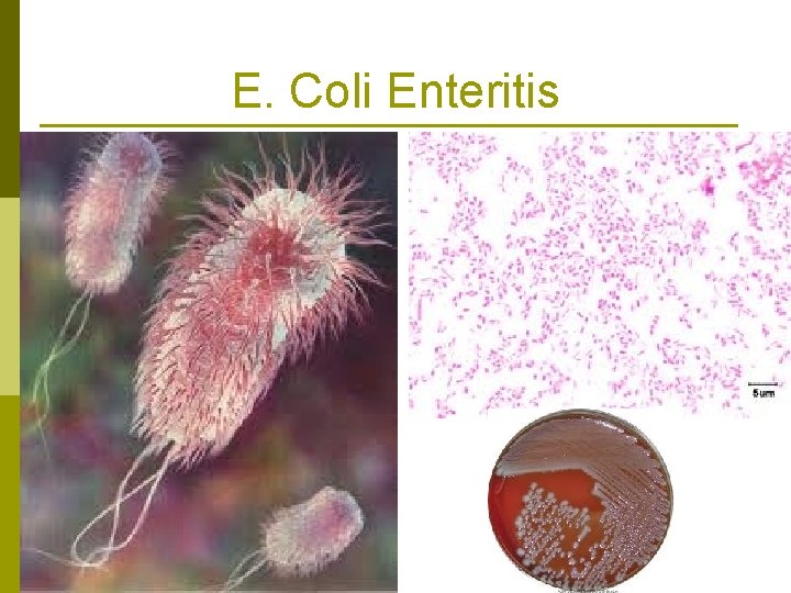 Human Pathogens Bacteria Fungus Protozoan Virus Parasite Needed