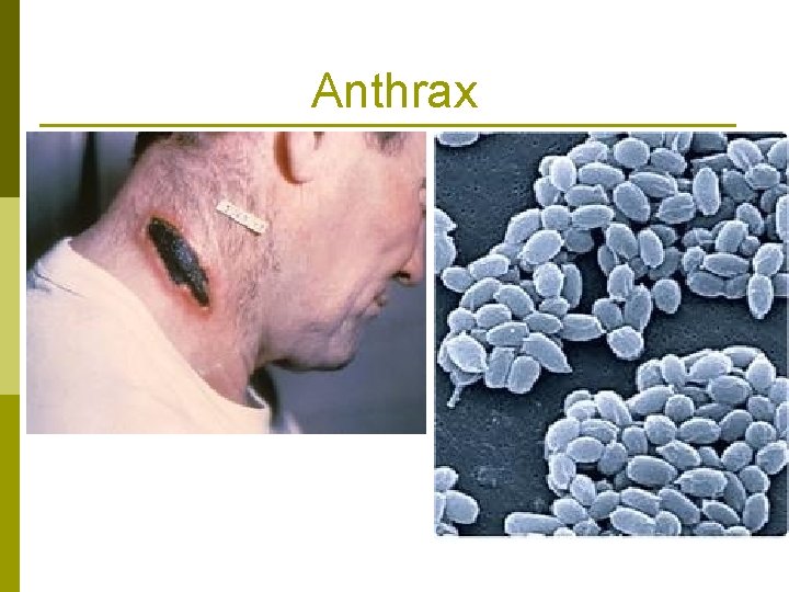Human Pathogens Bacteria Fungus Protozoan Virus Parasite Needed