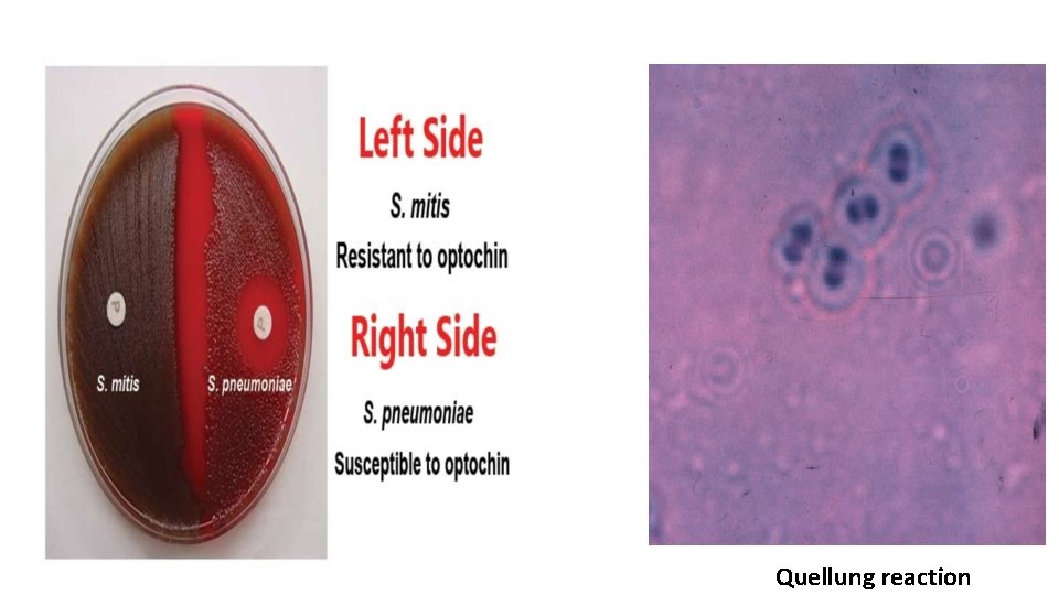 Bacterial infections of the Respiratory tract 2 By
