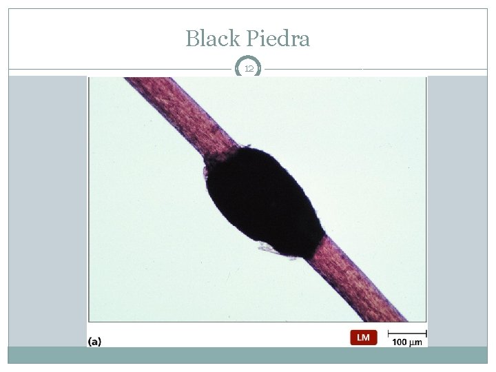 SUPERFICIAL CUTANEOUS MYCOSES 1 DR DAGGASH B BATULA