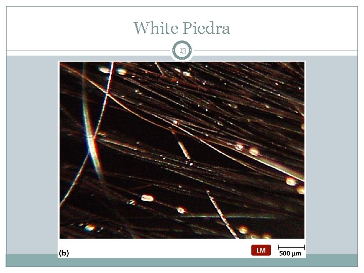 SUPERFICIAL CUTANEOUS MYCOSES 1 DR DAGGASH B BATULA