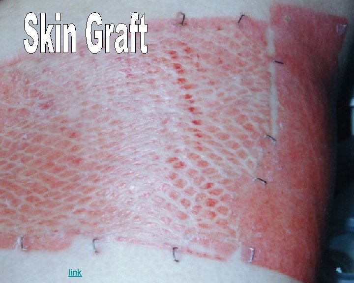 Skin Body Membranes Chapter 4 Classification of Body