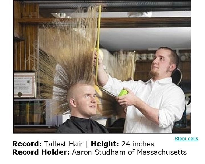 Skin Body Membranes Chapter 4 Classification of Body