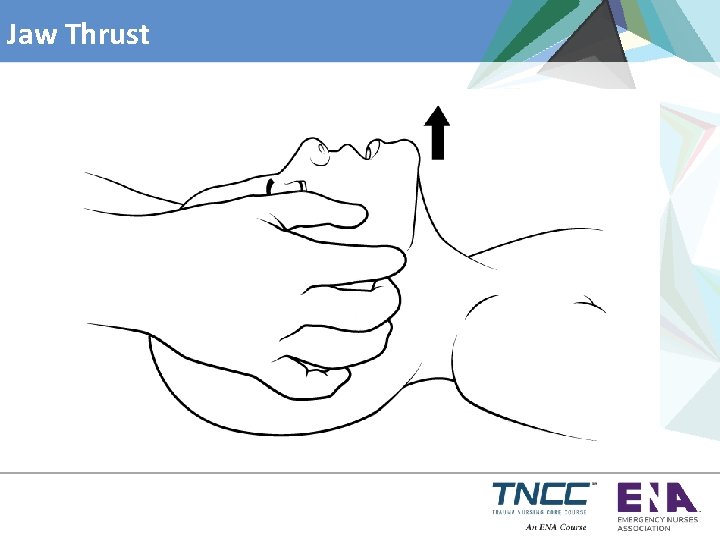 Chapter 4 Airway and Ventilation Objectives Describe pathophysiologic