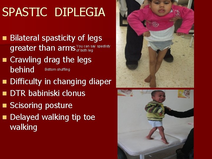 CEREBRAL PALSY DR OMAR ALI NAFI MRCPire Cerebral