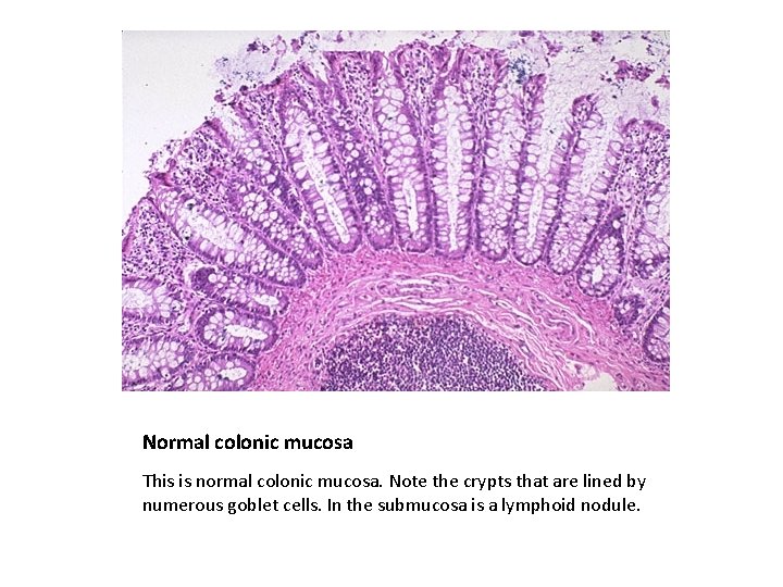 GI lab 2 Small and large intestines Normal