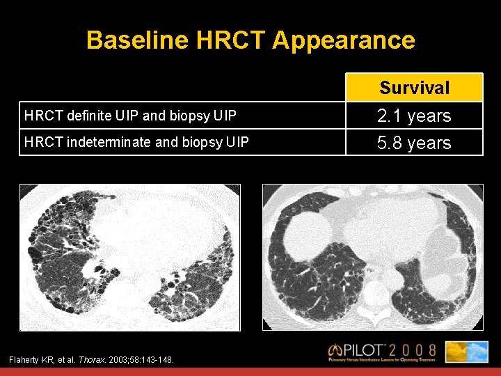 IPF Natural History and Prognostic Indicators Learning Objective