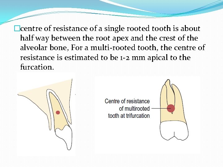 Biological and mechanical principles of orthodontic tooth movement