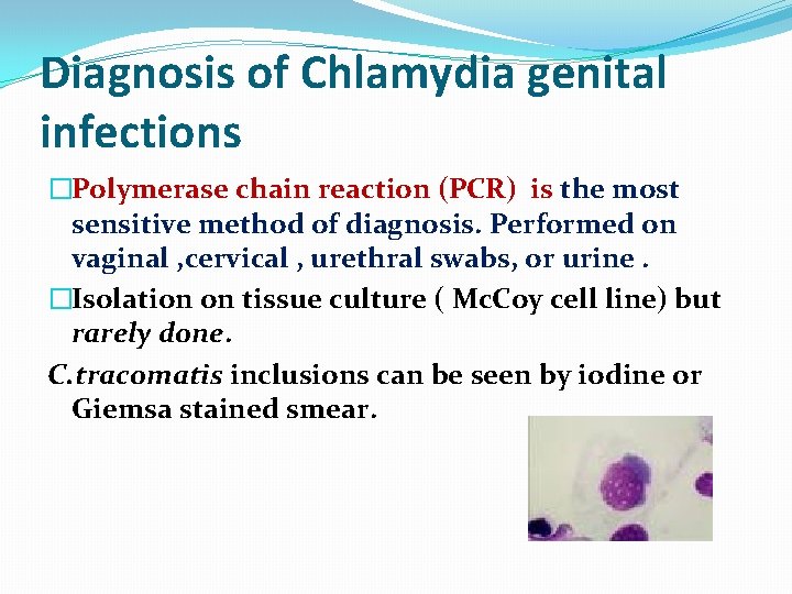 Chlamydia Syphilis Gonorrhea Reproductive Block Prof Hanan Habib
