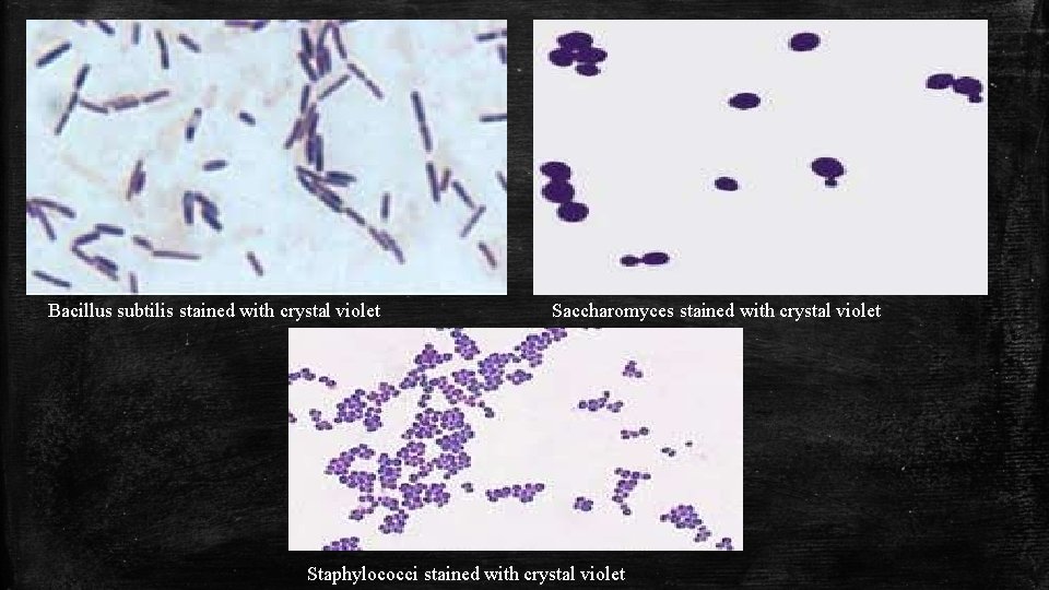 Bacterial staining Dr Dunith Liyanagamage MBBS Dyes Why