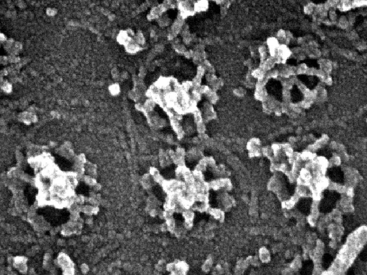 The Cell Part 2 Cisterna Ribosomes Polyribosome mRNA
