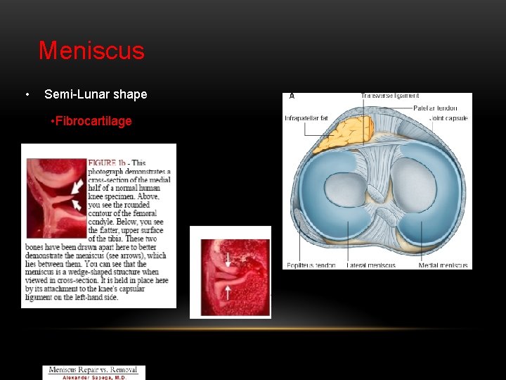 MENISCAL REPAIR Anatomy and Physiology of the Meniscus