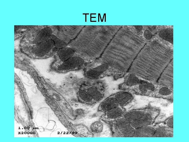 Endoplasmic Reticulum The endoplasmic reticulum contains a network