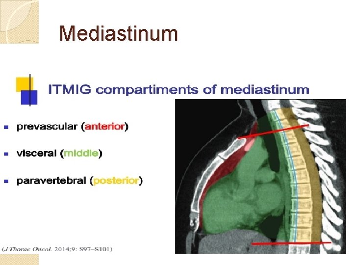 Imaging of mediastinum Mikhail Liubchak Radiologist MSc EDIR