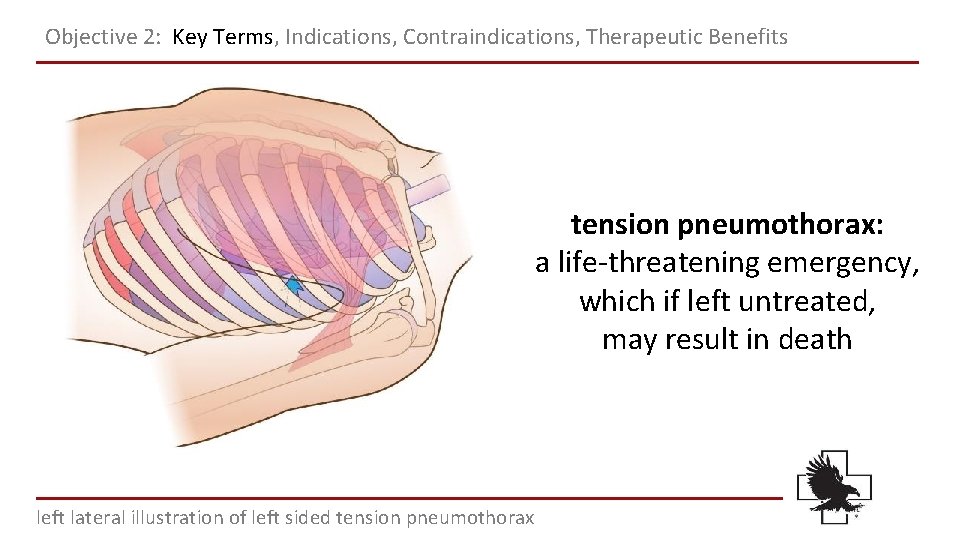 Simple Thoracostomy Kit Procedural Training Program Rev A