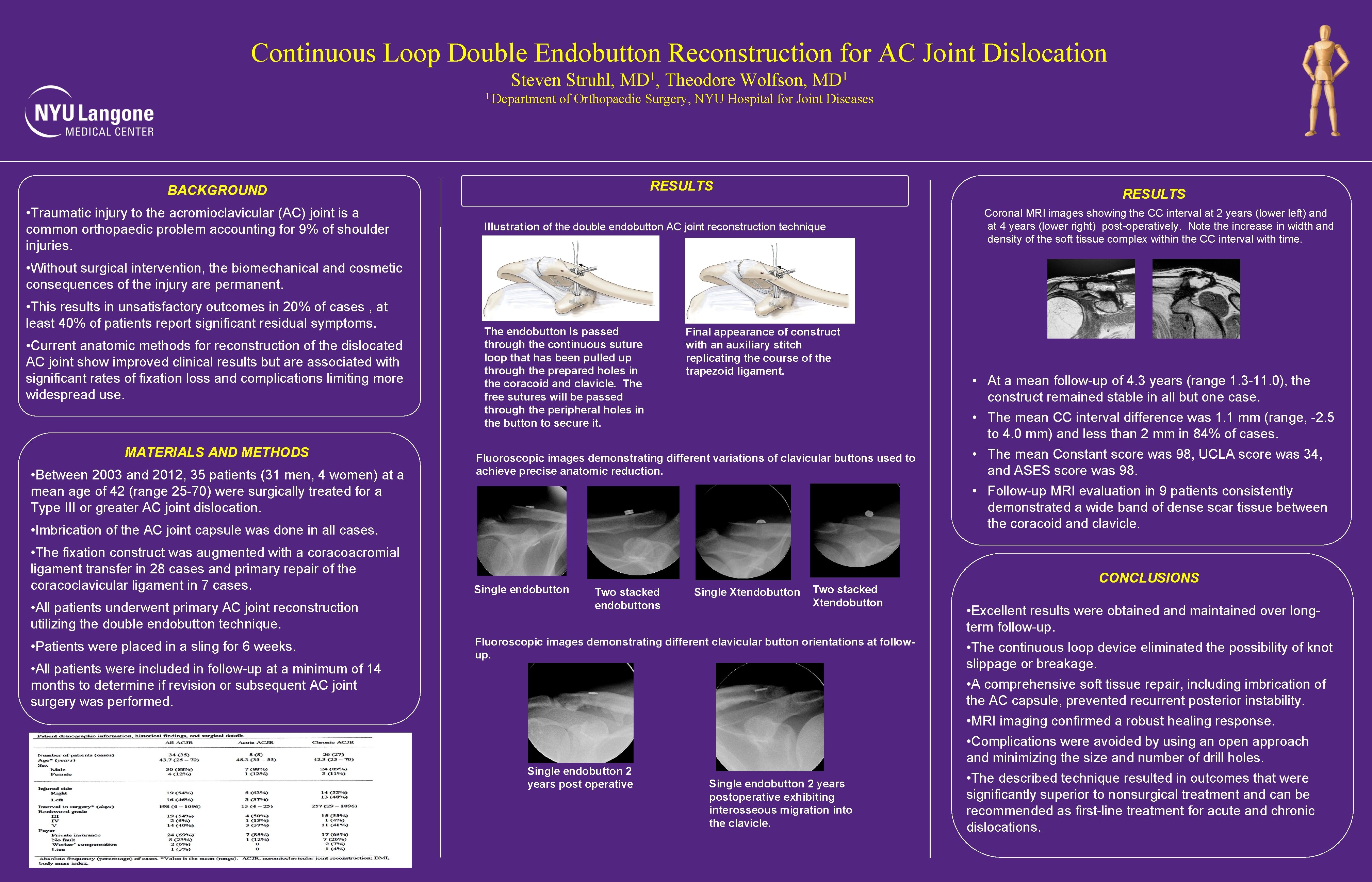 Continuous Loop Double Endobutton Reconstruction for AC Joint