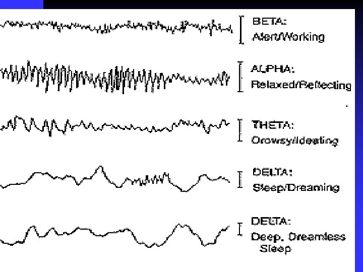 BRAIN ACTIVITY Electroencephalogram n EEG Recording of electric