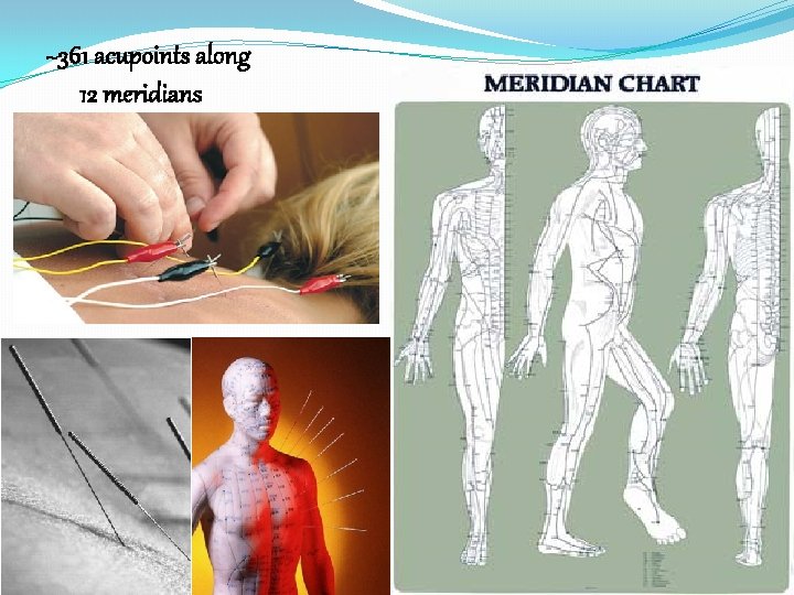 Acupuncture Overview Traditional Chinese Medicine Background Conceptual ...