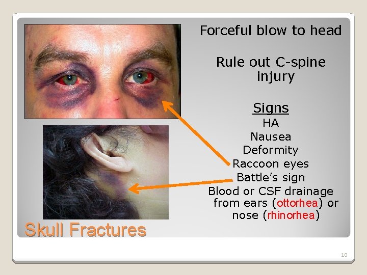Head and Face Injuries Anatomy and Select Facial