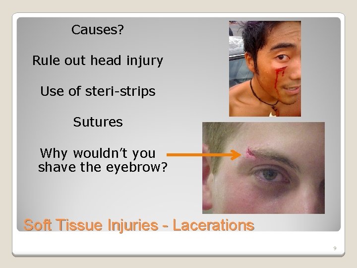 Head and Face Injuries Anatomy and Select Facial