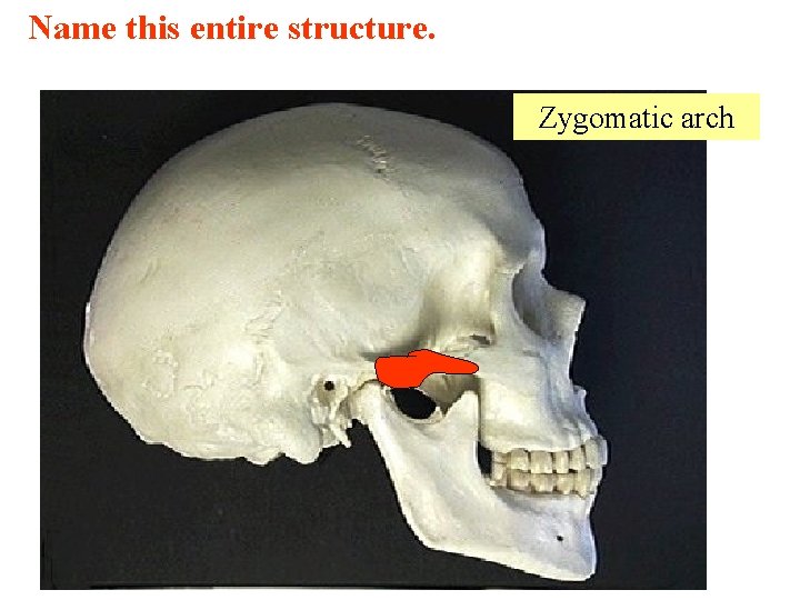 LETS REVIEW THE BONES OF THE SKULL Here