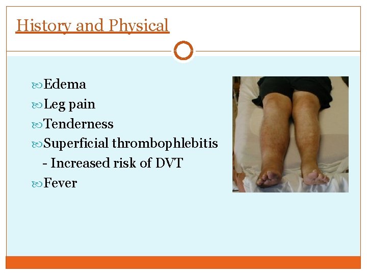 Deep Venous Thrombosis TURANDOT SAUL M D SEPTEMBER